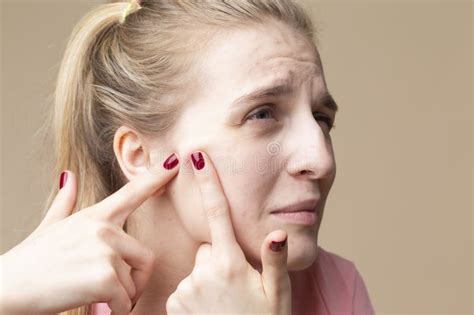 Skin Issues. Portrait of Young Emotional Caucasian Blond Woman with Skin Problems Squeezing ...