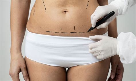 4 fatos sobre cirurgia plástica que todos dev... | BOA FORMA