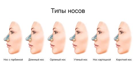 Операция ринопластика – как проходит, подготовка и реабилитация | Статьи