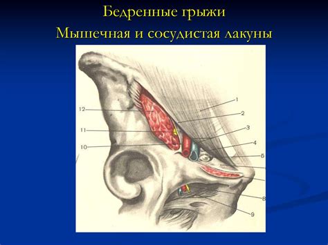Грыжи. Этиология, патогенез, классификация, клиника, диагностика и ...