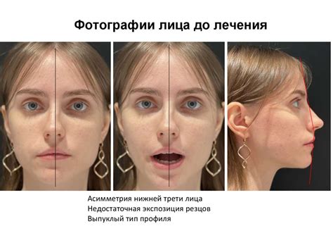 Анализ клинического случая. Стоматология - презентация онлайн