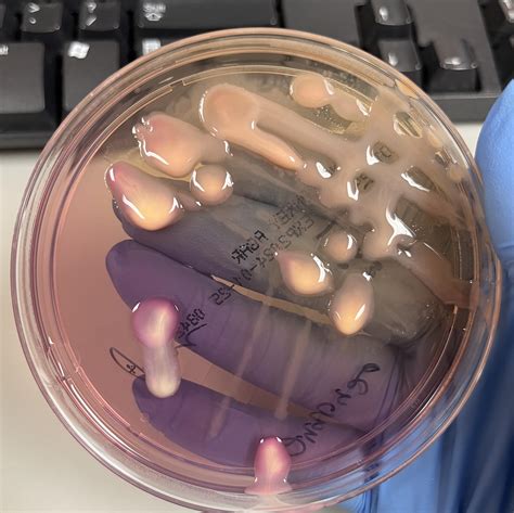 Klebsiella pneumoniae : r/medlabprofessionals