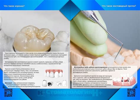 Каталог технологий 🔬 сеть клиник Стоматология Н+ в Днепре