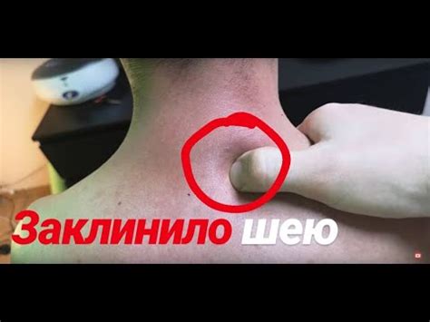 Устранение триггерных точек и функциональных блоков - YouTube
