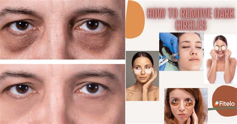 How To Remove Dark Circles At Home Naturally ( 10 Foods To Eat)