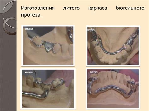Ортопедическая стоматология. История болезни Трухачева В.Ю ...