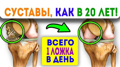 Наша гимнастка призналась: сохранить суставы здоровыми помогает простая ...