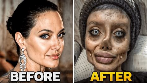 Celebrities Unrecognizable After Plastic Surgery Gone Wrong | Then And ...