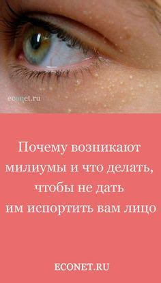 Почему возникают милиумы и что делать, чтобы не дать им испортить вам ...