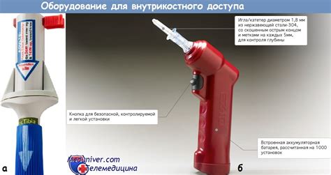 Методика внутрикостной инфузии у новорожденных детей