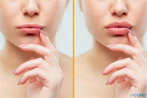 Cómo Dar Volumen A Los Labios De Forma Natural | FactoryDrip