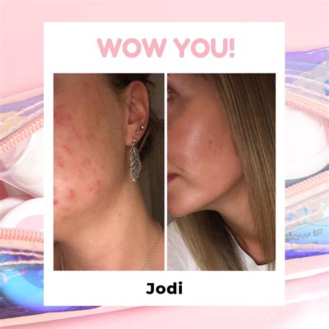 ready, set, glow! - Wow You Beauty