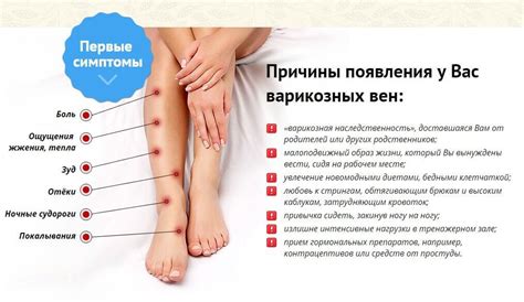 Купить Флеболайф гель от варикоза. Цена ниже, чем в аптеке