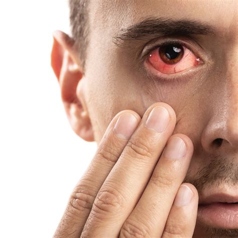 Techniques pour apaiser les yeux rouges après l'utilisation d'écrans