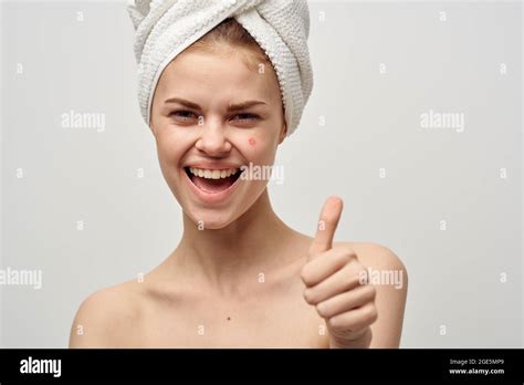 pretty woman with a pimple on the face dermatology isolated background Stock Photo - Alamy