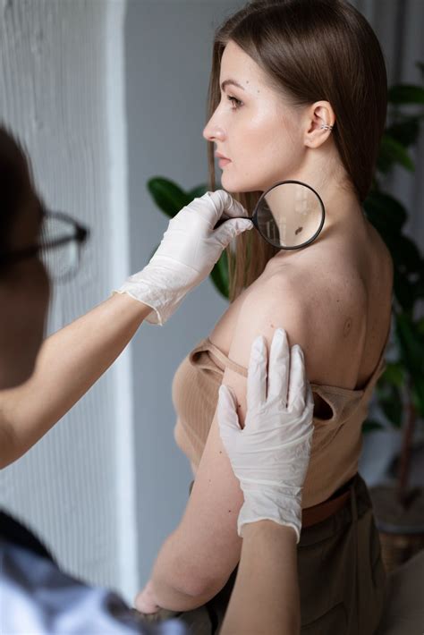 Merkel Cell Carcinoma – מה זה וכיצד מטפלים בו?
