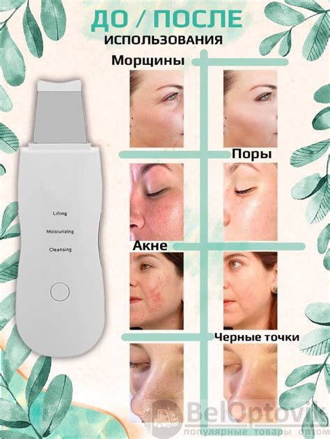 Ультразвуковой аппарат для пилинга и лифтинга с функцией увлажнения ...