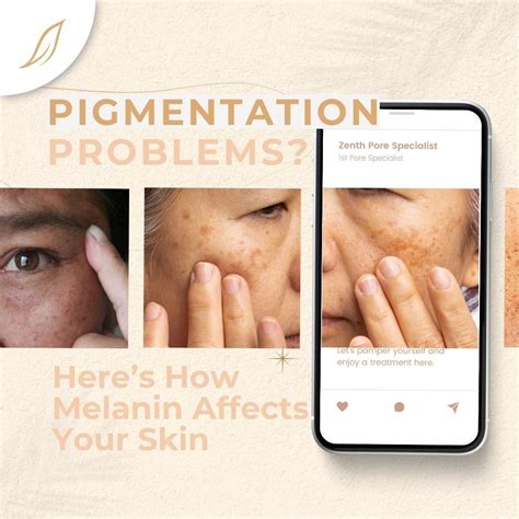 Pigmentation Problems? Here’s How Melanin Affects Your Skin - Zenth Beauty Sdn Bhd - Selangor ...