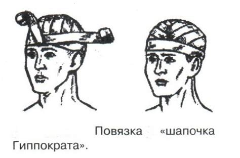 Требования к готовой повязке