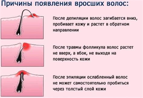Шугаринг Аравия. Отзывы о пасте. Обучение, видео уроки у ...