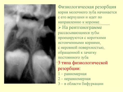 Анатомо-морфологические особенности формирующейся зубочелюстной системы ...