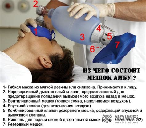 Мешок амбу: принцип действия и правила использования