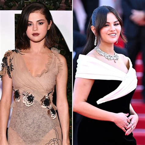 Selena Gomez Face Surgery Unveiling the Truth Behind the Speculations - International Plus