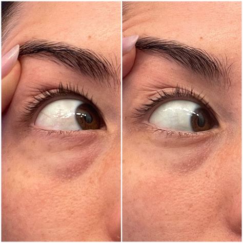 Lumify Eye Drops Review: See Photos | POPSUGAR Beauty