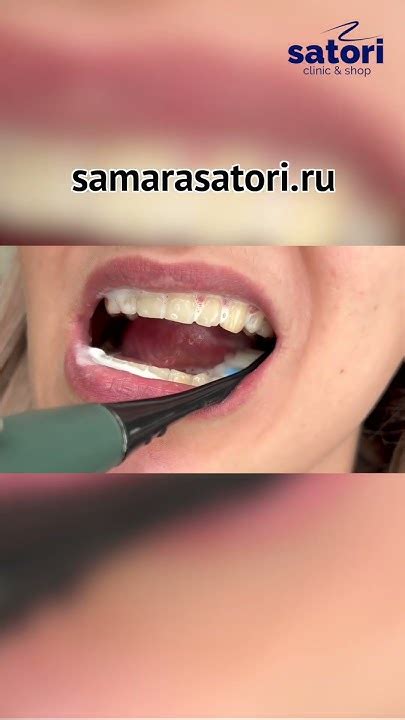 Электрическая или обычная зубная щетка? - YouTube