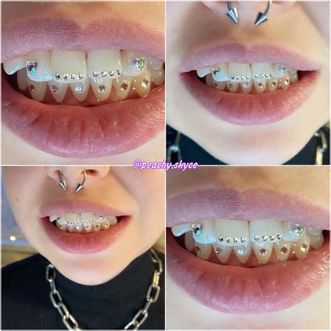 Скайсы на зубы в СПб | Nose ring, Septum ring, Rings