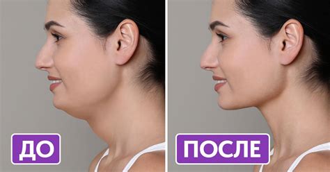 Второй подбородок и как его убрать