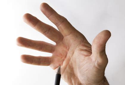 Pathologies de la main Archives - Institut Français de Chirurgie de la Main