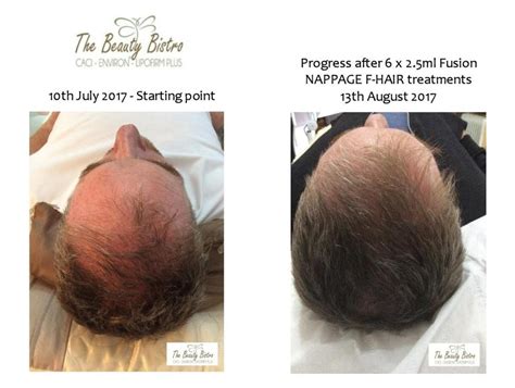 f-hair-before-after