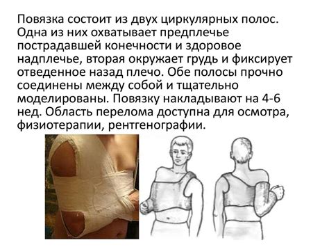 Повреждение ключицы. Лечение - презентация онлайн