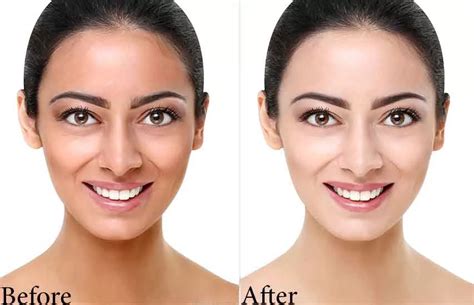 High Quality Cosmetic Peptide Nonapeptide-1 Whitening Freckle Removing ...