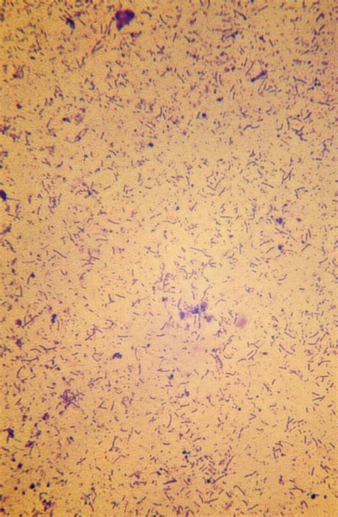 Yogurt bacterium – License image – 70336865 lookphotos