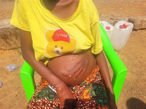 Pregnant woman claims she woke up to find bloody handprint on her belly after slapping a 'spirit ...