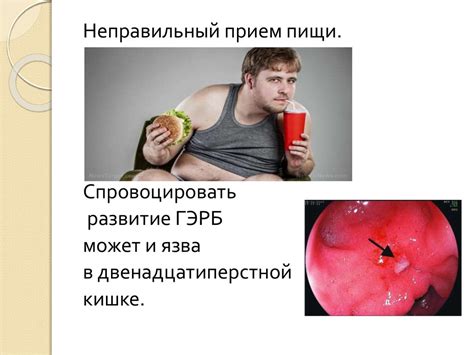 Болезни органов пищеварения - презентация онлайн