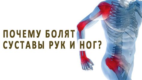 Почему болят суставы рук и ног? - YouTube