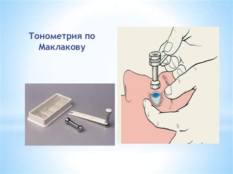 Тонометрия по методу маклакова