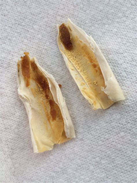 Ear Wax Candle