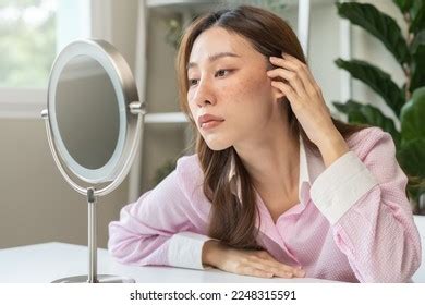 754 Melasma Asian Images, Stock Photos & Vectors | Shutterstock