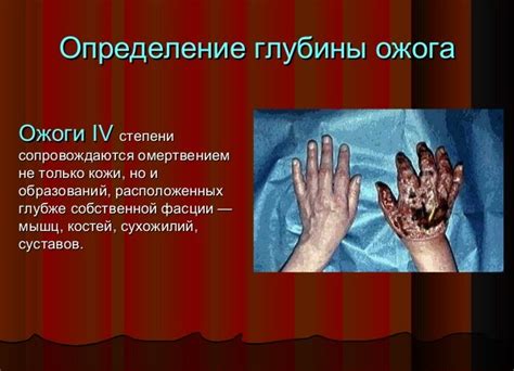 Огнестрельные ранения