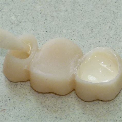 Visalys Temp A2 50ml - Optident - Specialist Dental Products And Courses