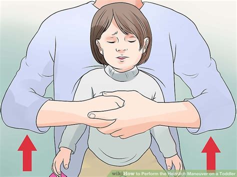3 Ways to Perform the Heimlich Maneuver on a Toddler - wikiHow