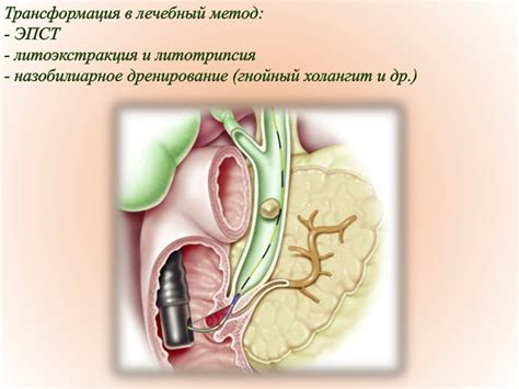 Диагностика желчекаменной болезни - презентация онлайн