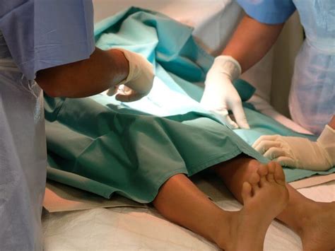 Pakar Pediatrik Jelaskan Perbezaan Proses Anak Hemofilia Bersunat