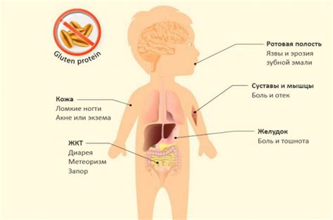 Є глютен в кукурудзі: в якій кількості міститься, корисний чи шкідливий