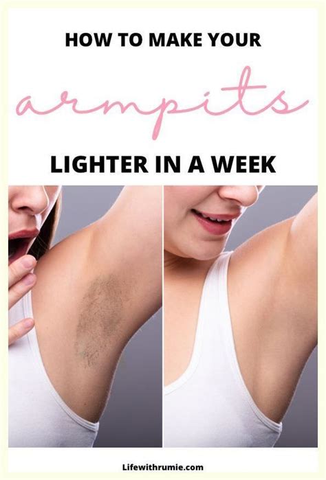 How To Whiten Underarms Fast and Naturally in 2022 | Dark underarms, Dark armpits, How to whiten ...