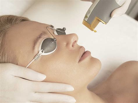 Laser Genesis Treatment North Vancouver